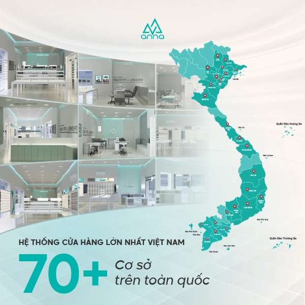 Kính mắt Anna có bao nhiêu cửa hàng? - Kính mắt Anna